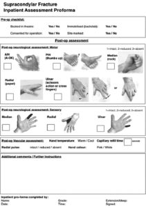 supracondylar-humerus-fractures-orthosho